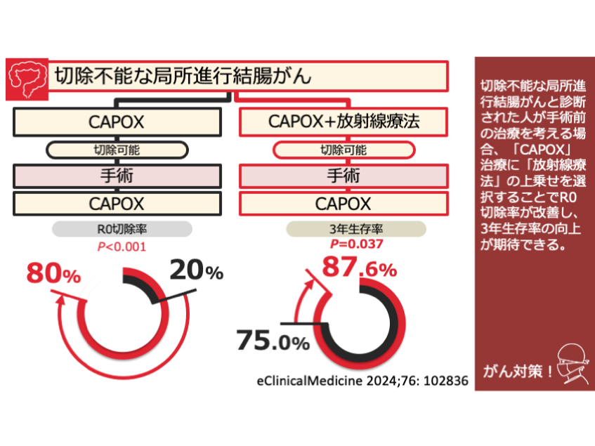 日本がん対策図鑑 | 【結腸がん：術前治療（3年OS）】「CAPOX＋放射線療法」vs「CAPOX」